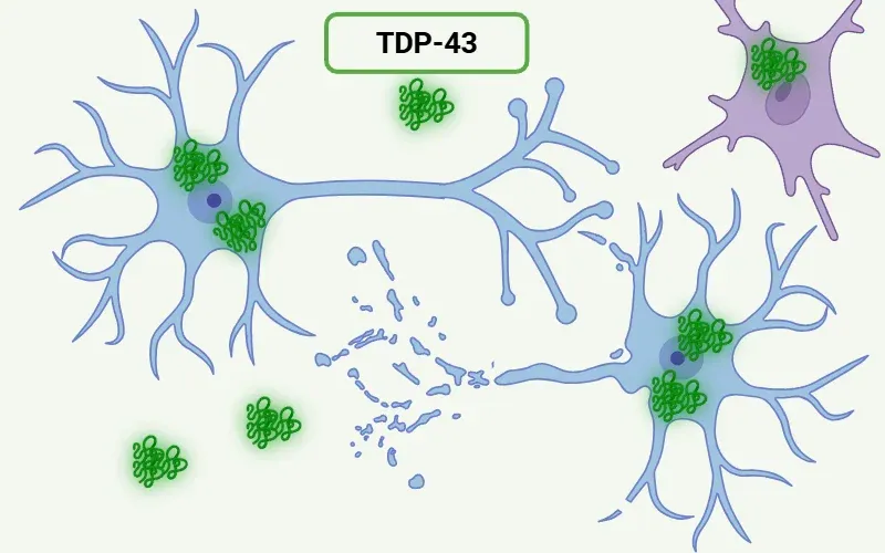 TDP-43 - Its Role in Drug Development for ALS & FTD